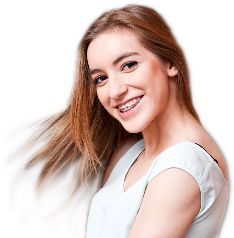 Braces Smile , Png Download Clipart - Large Size Png Image - PikPng