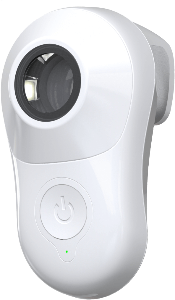 Scalp Disorders Such As - Instant Camera Clipart - Large Size Png Image ...