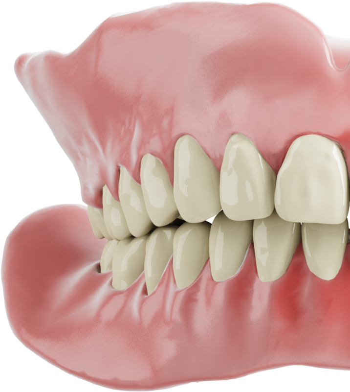 Front Denture - Dentures Clipart - Large Size Png Image - PikPng