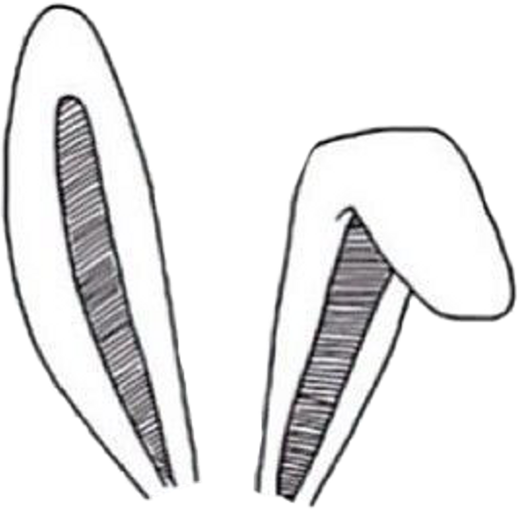 Bunny Head Png Clipart - Large Size Png Image - PikPng