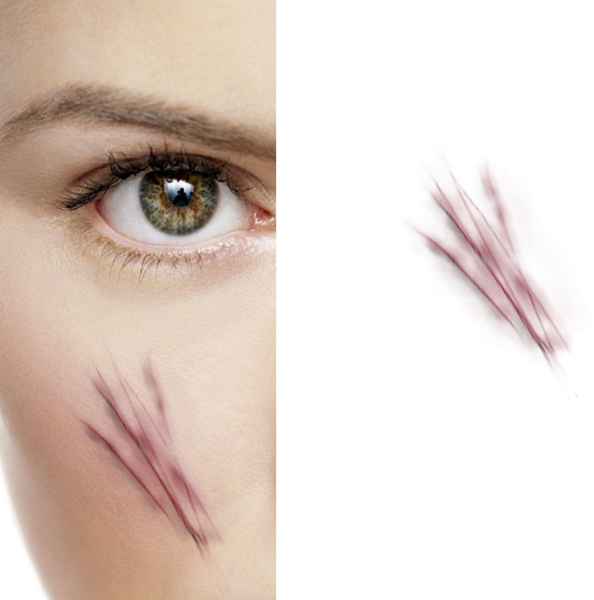 Create Scratches - Stitches On Face Png Clipart - Large Size Png Image ...