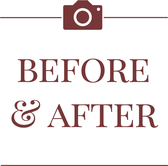 Before Png - Before After Photo Png Clipart - Large Size Png Image - PikPng