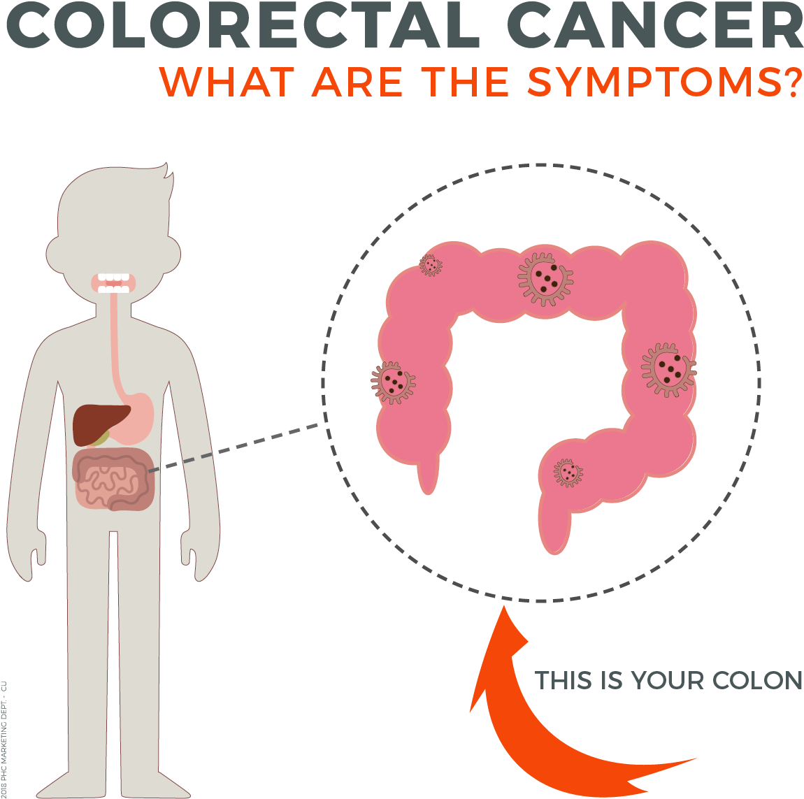 Symptoms Of Colorectal Cancer, The Body's Digestive - Human Body ...