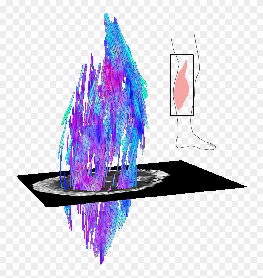 How Do Muscles Change Shape When They Are Passively - Diffusion Tensor ...