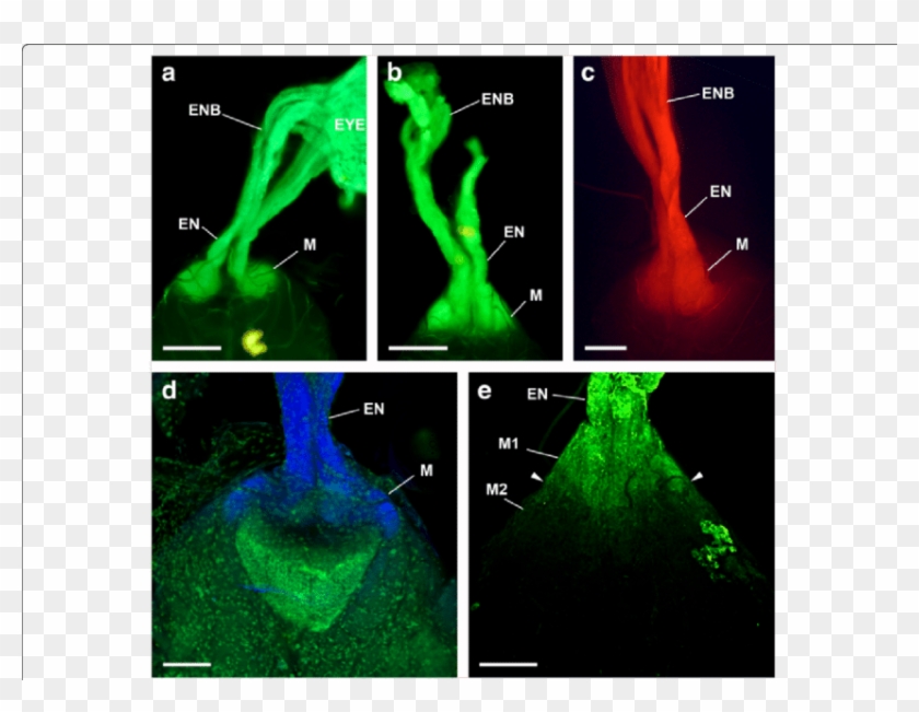 Dio And Dii (c) - Medical Imaging Clipart (#1359060) - PikPng