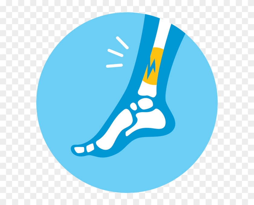 Possible Broken Bones Or Simple Fractures - Bone Fracture Icon Png ...