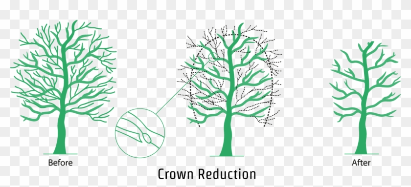 An Illustration Showing The Crown Reduction Process Clipart (#5769332 ...